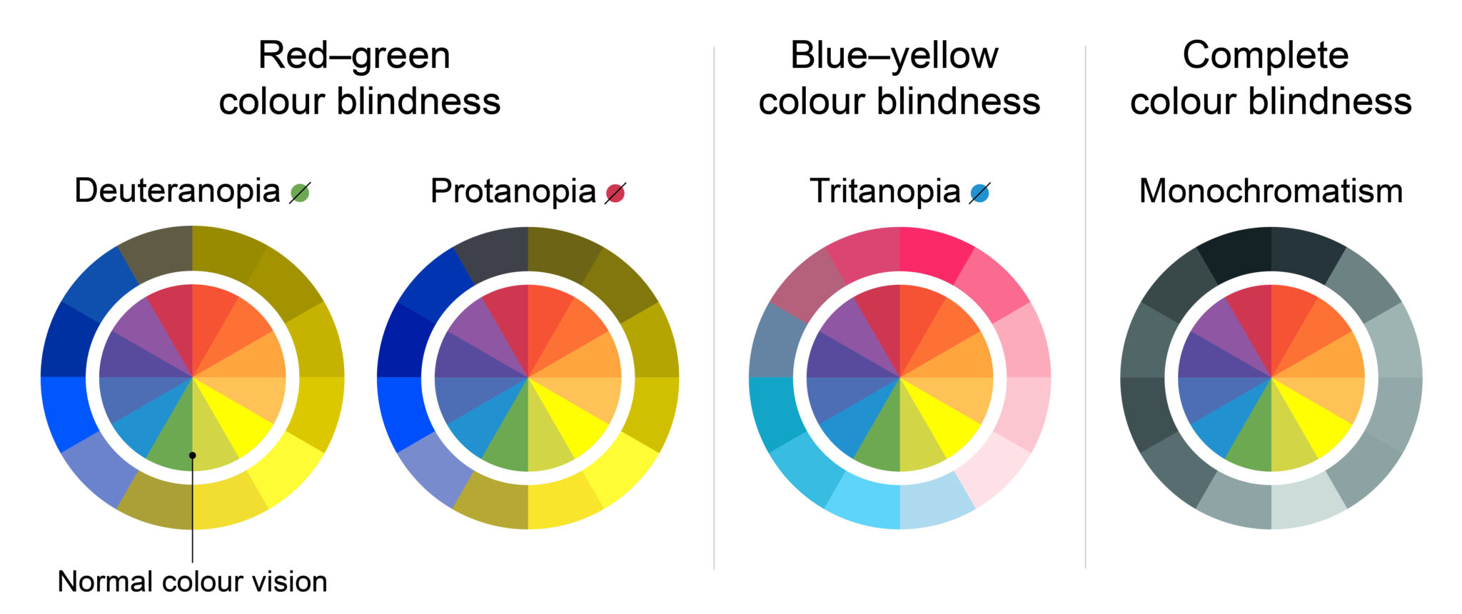 Color Blindness Causes Types And Treatment My Blog